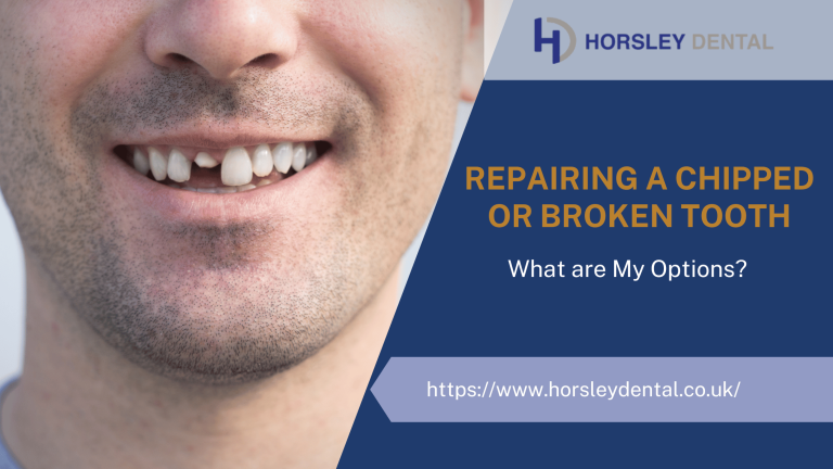 Repairing A Chipped Or Broken Tooth: What Are My Options? – Horsley ...