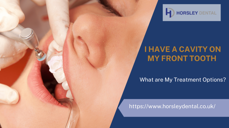 I Have A Cavity On My Front Tooth: What Are My Treatment Options ...